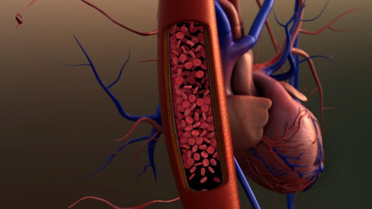 What causes problems with blood circulation? - Pharmacy Shop